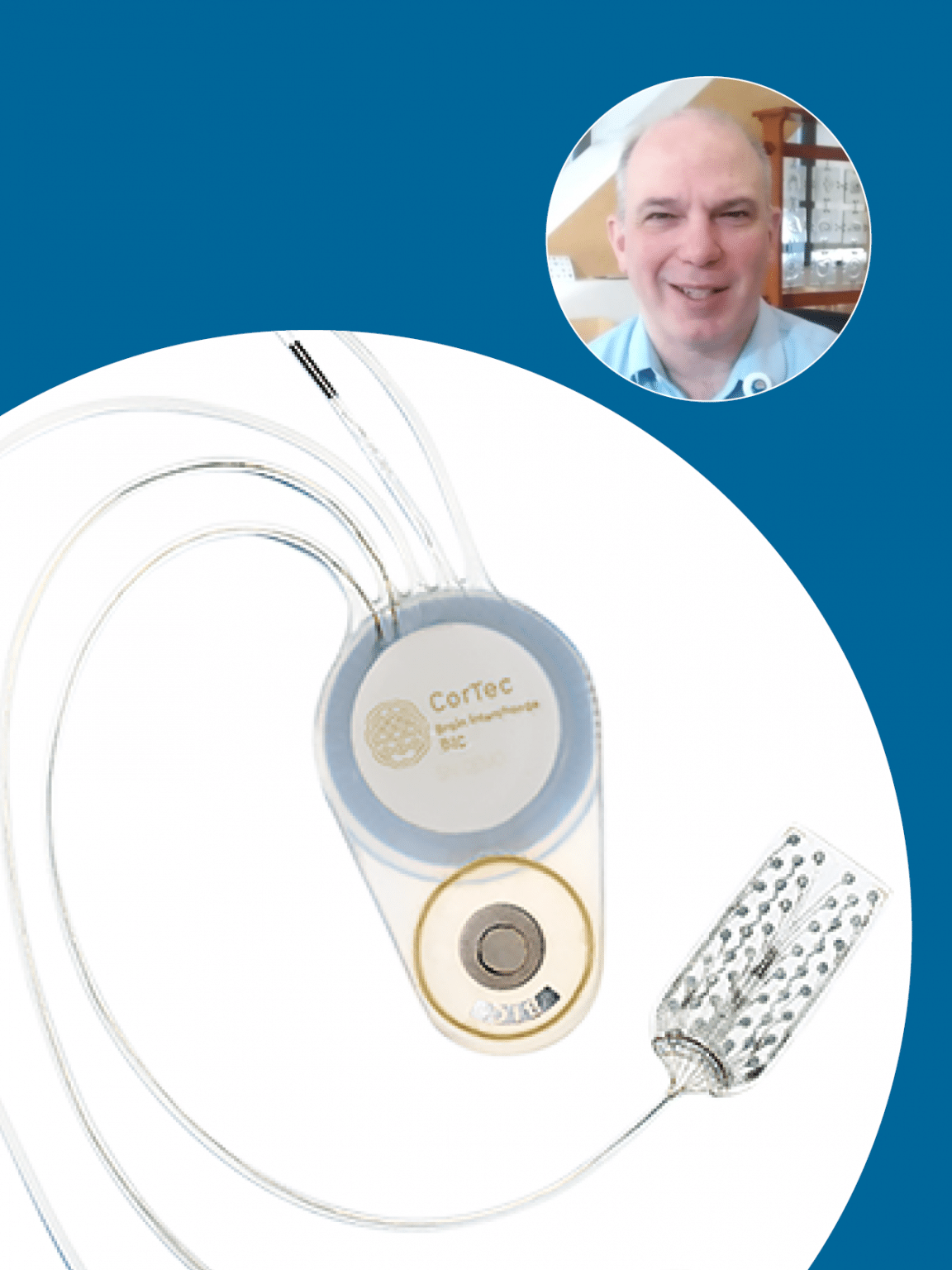 CorTec’ Brain Interchange implant system on track for first-in-man ...