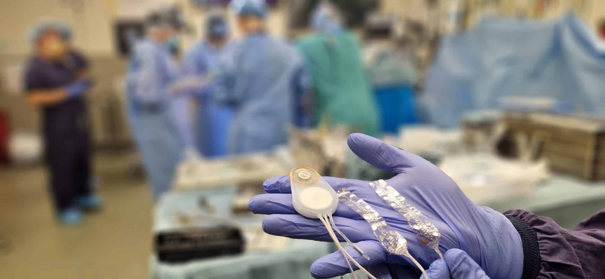 CorTec Announces Neurotech Milestone: First Human Implantation of a ...