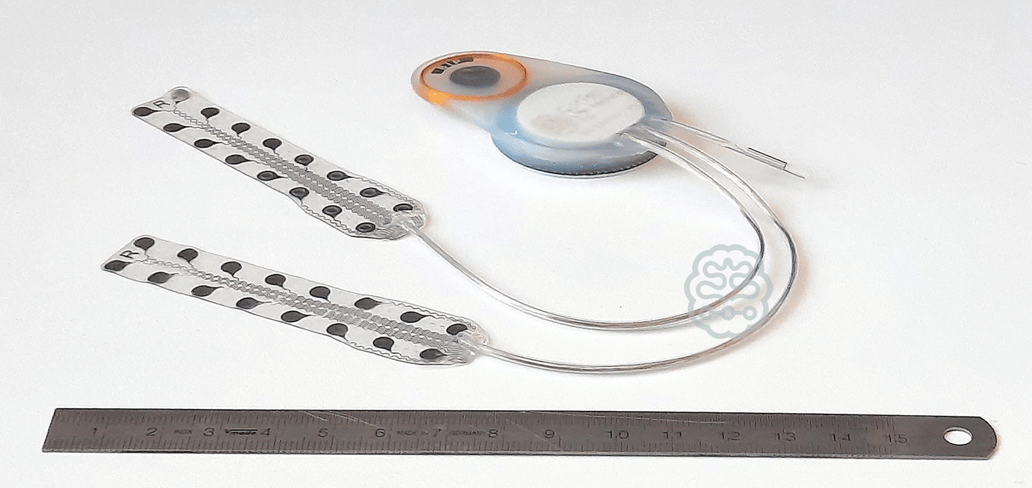 CorTec Announces Neurotech Milestone: First Human Implantation of a Brain-Computer Interface ...